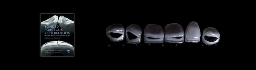 Pascal Magne- Bonded Porcelain Restorations - A Biomimetic Approach