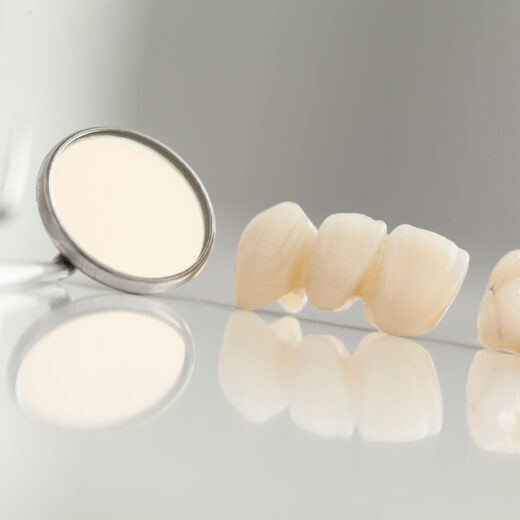 Biomimetic Dentistry & the tooth cycle of death