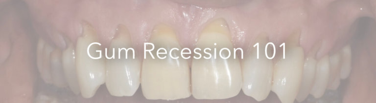 What Causes Gum Recession? - Causes, Prevention, and Treatments