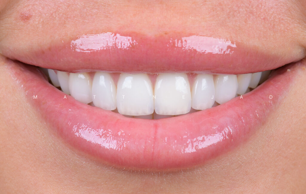 Before & Afters | Cosmetic Dentistry & Biomimetic Dentistry