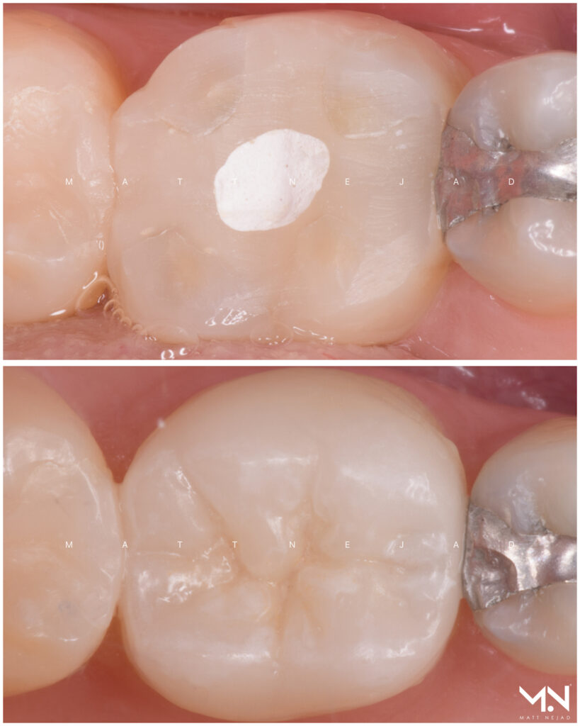 Biomimetic Dentistry Before and After Photos | Helm Nejad Stanley