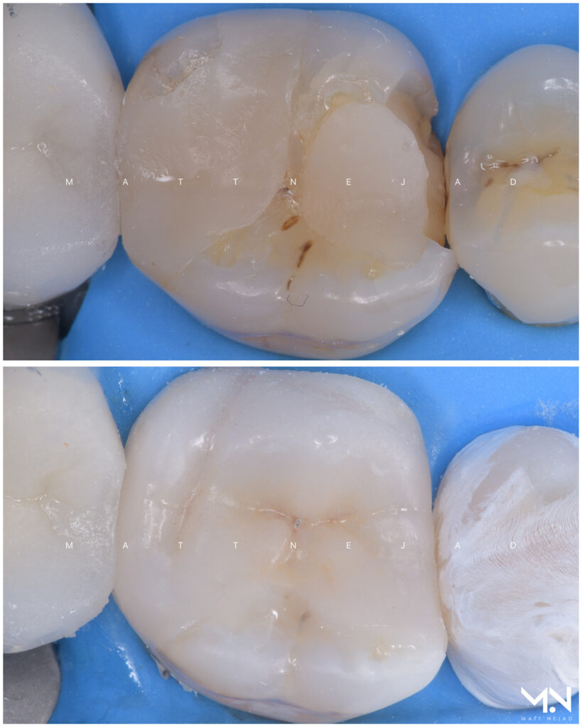Biomimetic Dentistry Before and After Photos | Helm Nejad Stanley
