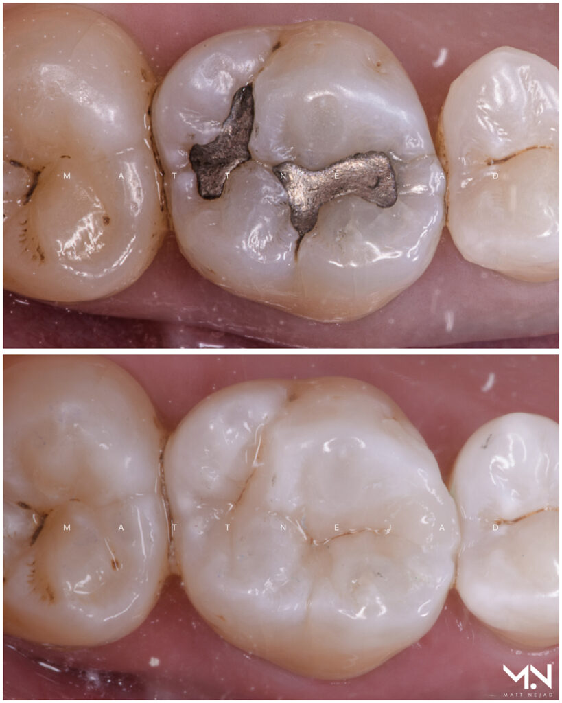 Biomimetic Dentistry Before and After Photos | Helm Nejad Stanley