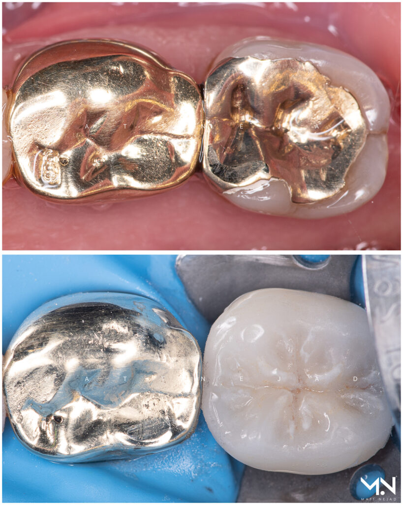 Los Angeles Biomimetic Dentistry | Beverly Hills, West Hollywood
